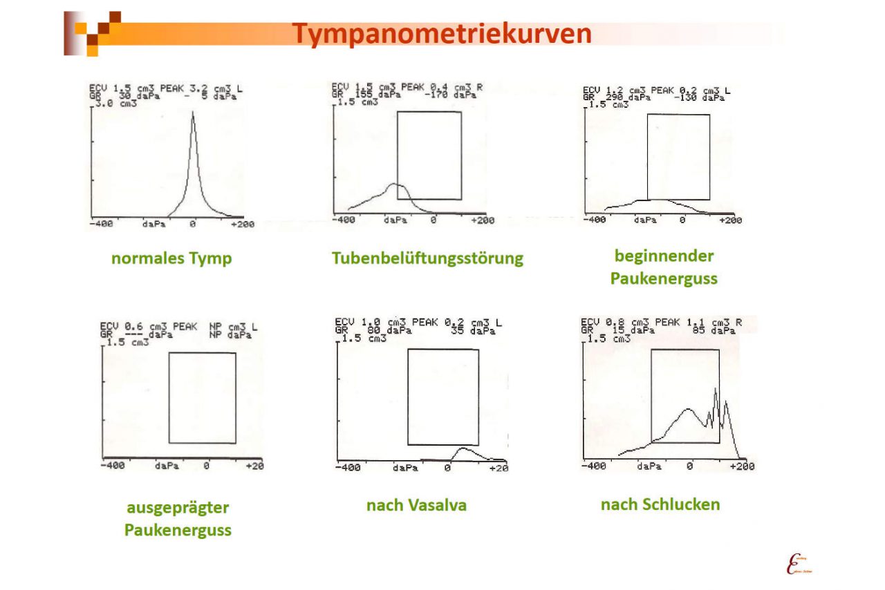 Seminarinhalte - Audiometrie-Schulung und Seminare für HNO Fachangestellte